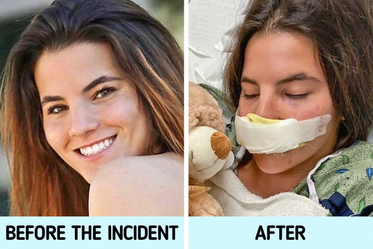 From Devastating Dog Attack to Defiant Resilience: Brooklinn Khoury’s ...